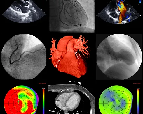 Diagnostics | Leading Cardiovascular Care